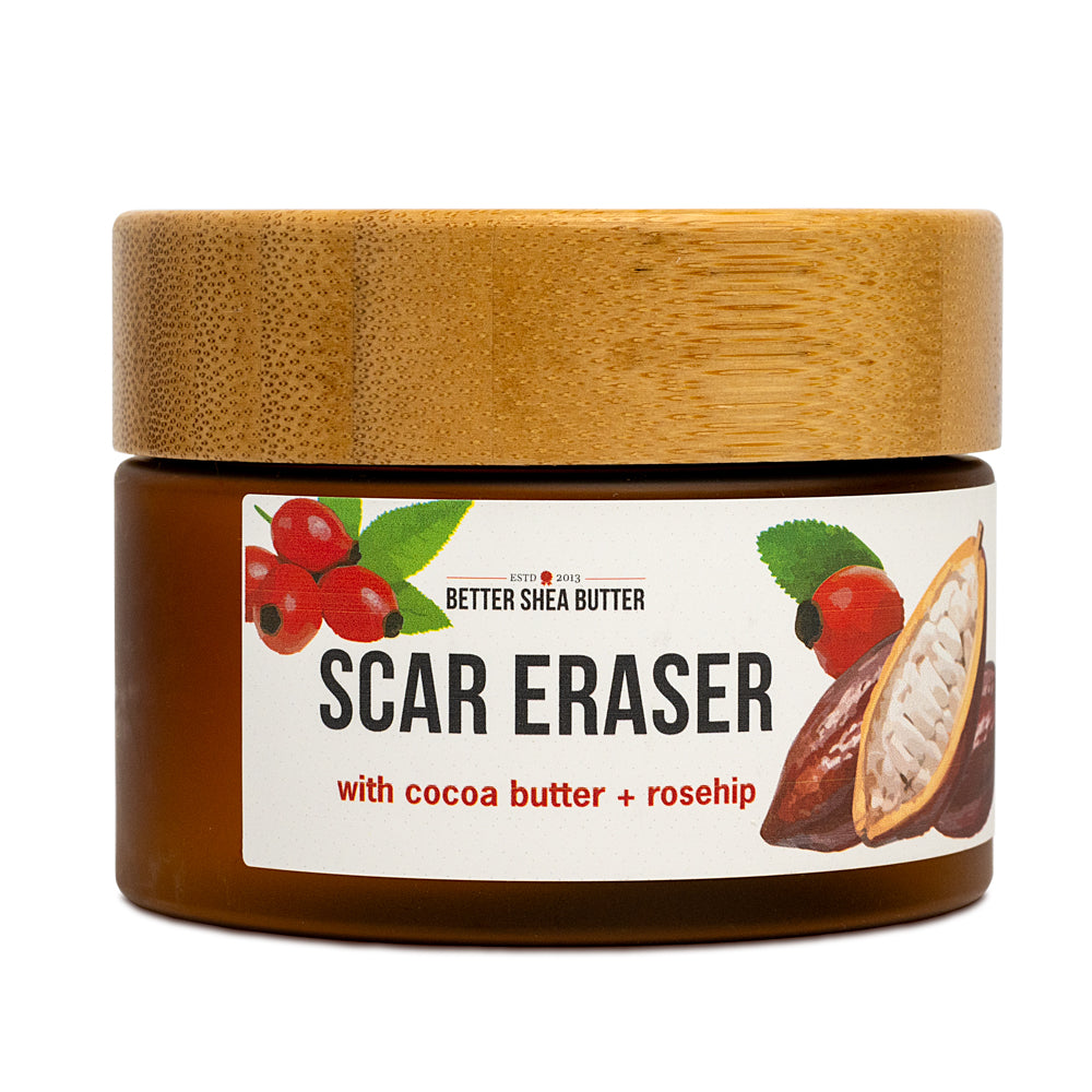 Scar Eraser with Cocoa Butter – Paradise Beauty Company